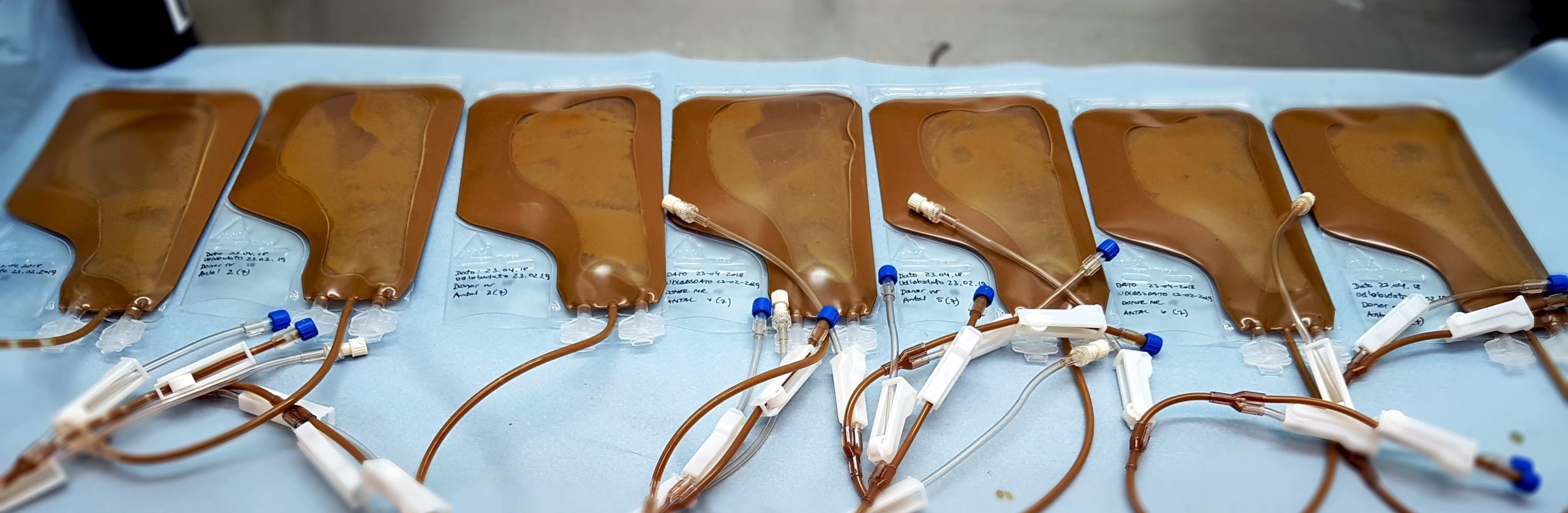 The Rise of Faecal Transplant Therapy: A New Hope for Gut Health – CFS News